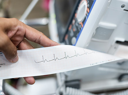 What is an EKG and what does it detect? Learn more about this common ...