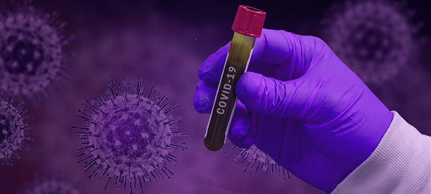 Department of Medical Microbiology and Immunology | UC Davis School of ...