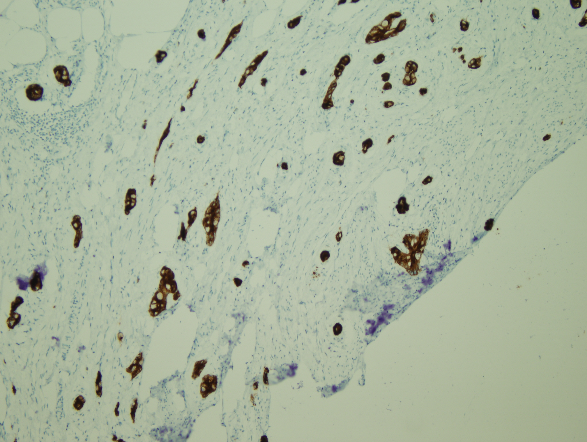 June 2012 Case of the Month Question | UC Davis Department of Pathology