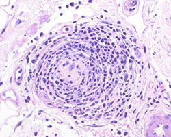 February 2020 | Case of the Month for Residency Program | UC Davis ...