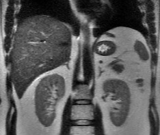 UC Davis MRI, MyMRI Patient Information Portal