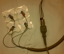 Cardiac MRI, Stress Cardiac Perfusion MRI or Chest MRI